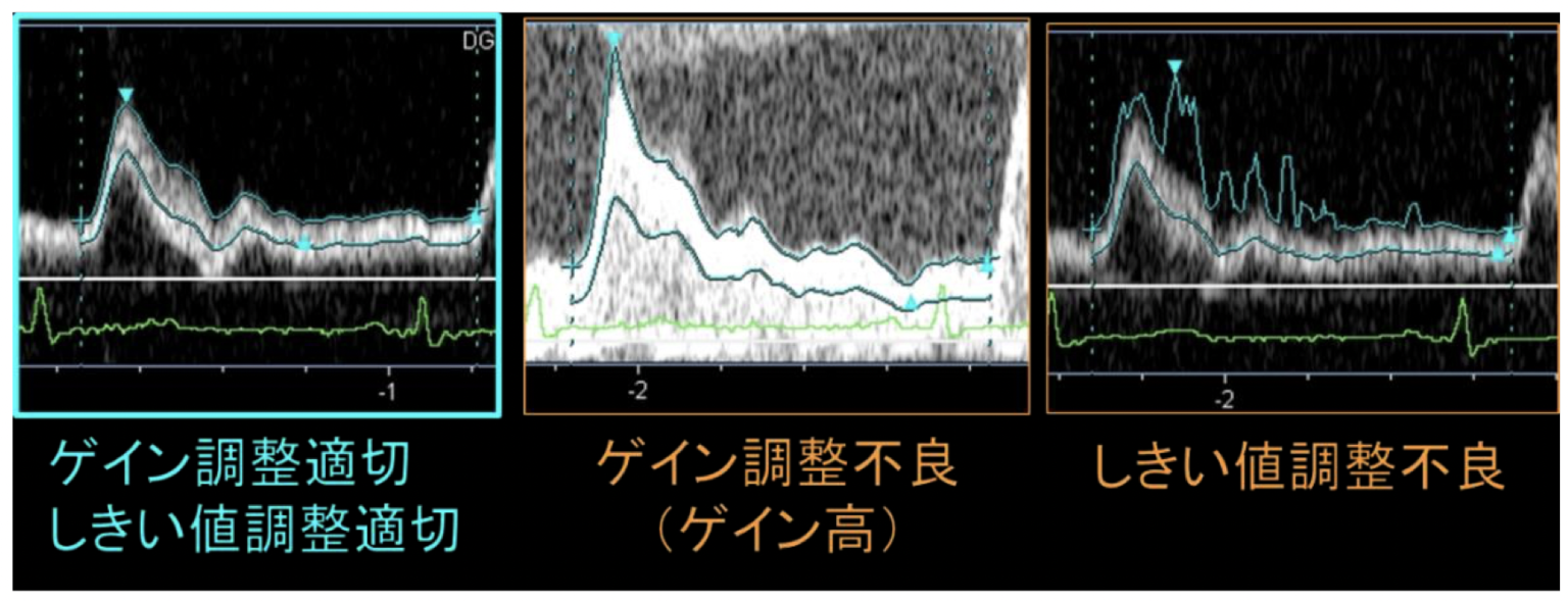 シャントエコー | me