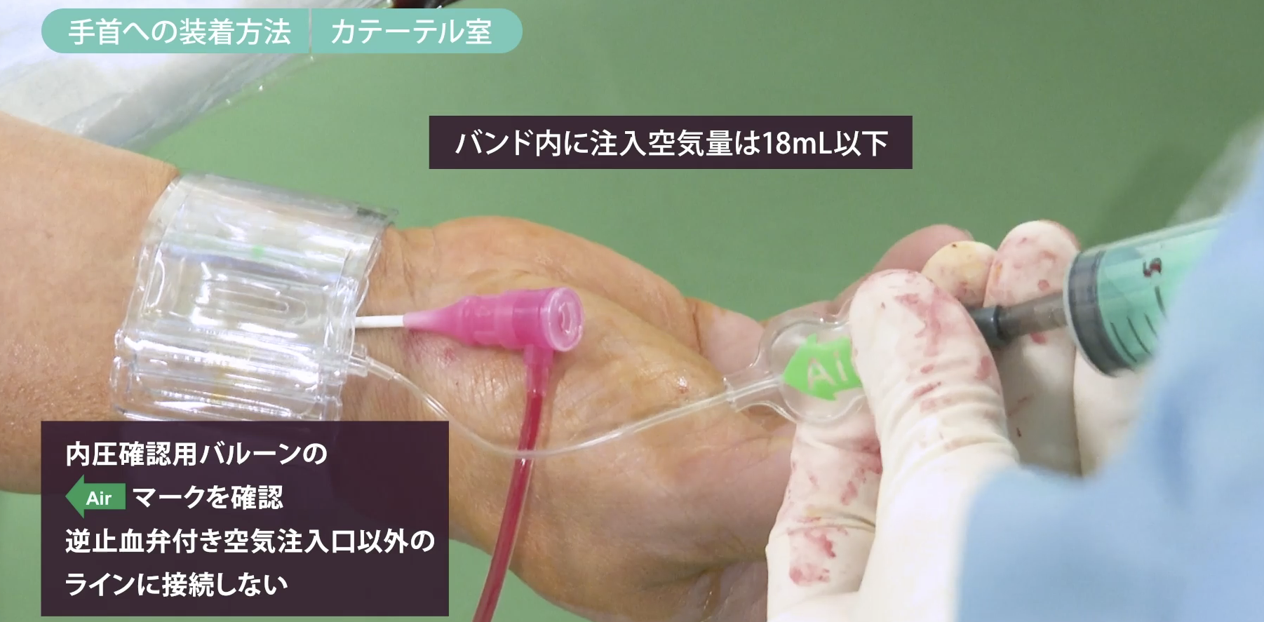 止血デバイスのTRバンド | me