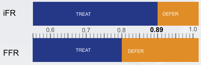 FFR（fractional flow reserve） | me