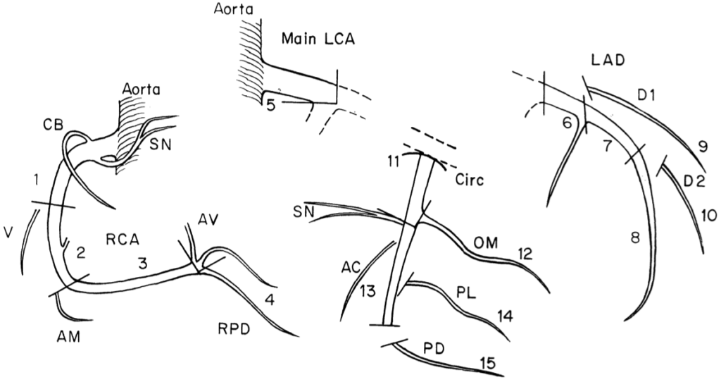 冠動脈造影CAG Coronary Angiogram | me
