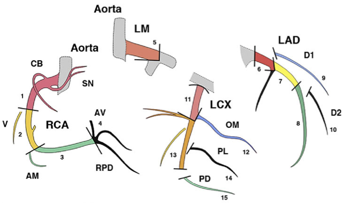 冠動脈造影CAG Coronary Angiogram | me