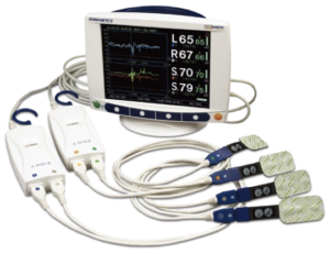 脳オキシメータの無侵襲混合血酸素飽和度監視システム（INVOS） | me