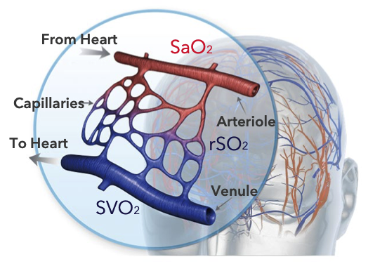 脳オキシメータの無侵襲混合血酸素飽和度監視システム（INVOS） | me
