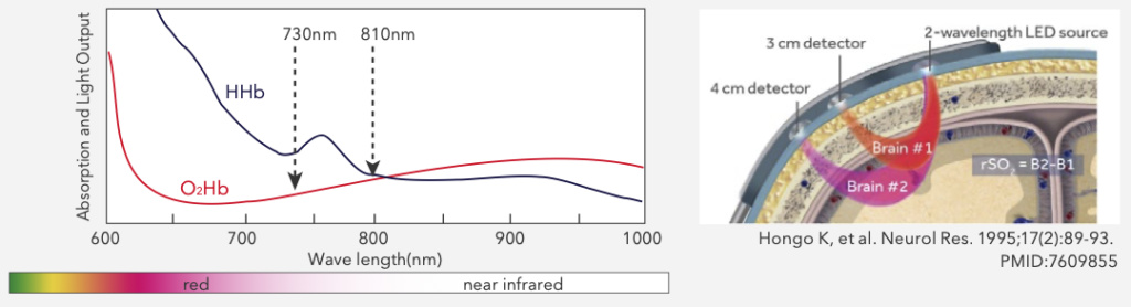 脳オキシメータの無侵襲混合血酸素飽和度監視システム（INVOS） | me
