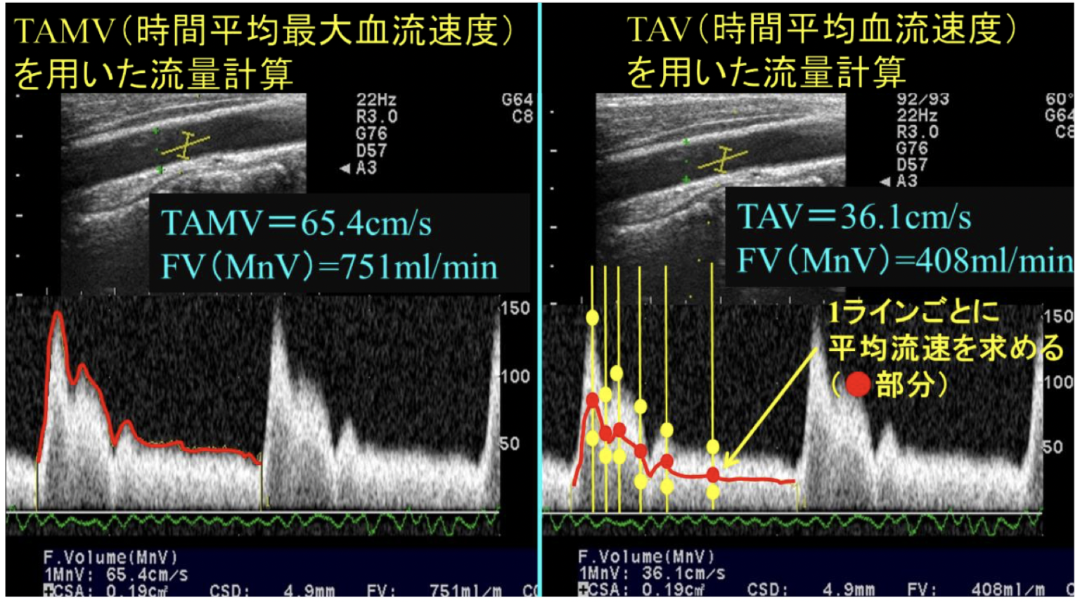 シャントエコー | me