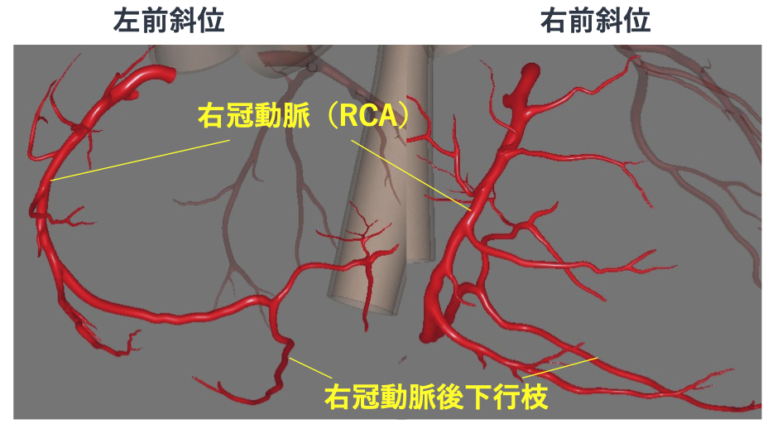 冠動脈の解剖と分類 | me
