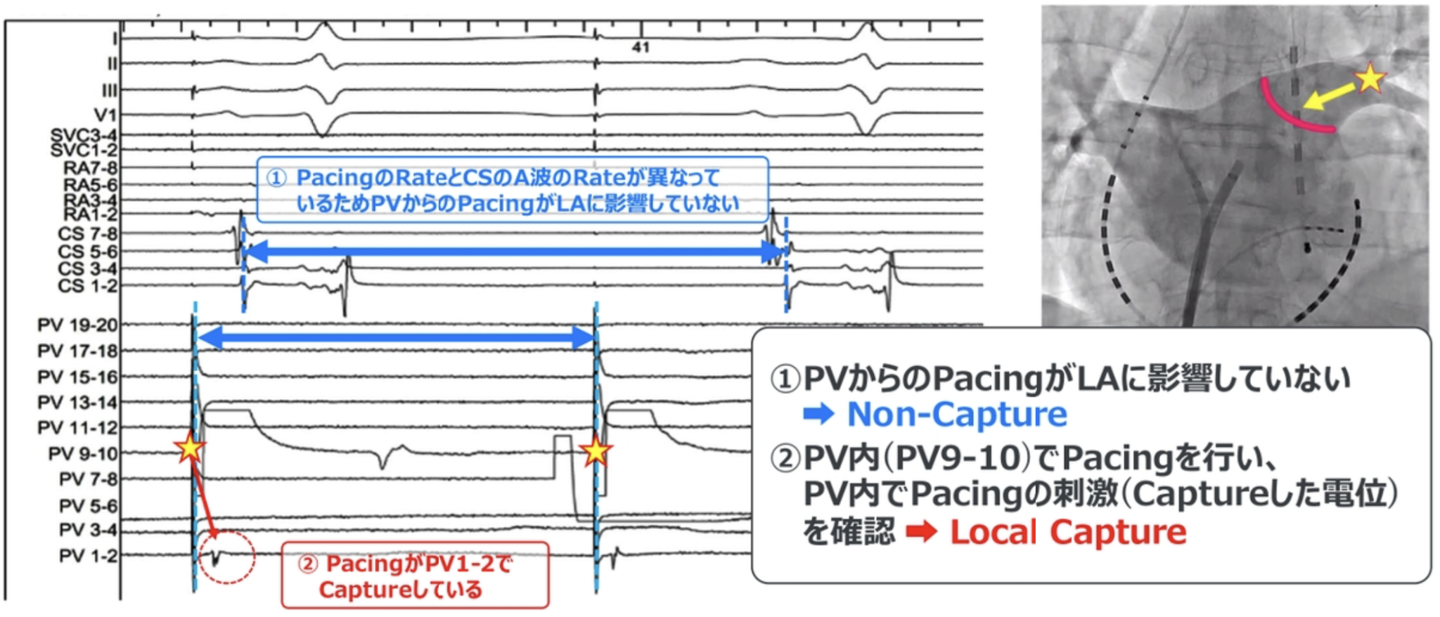 PVI | me