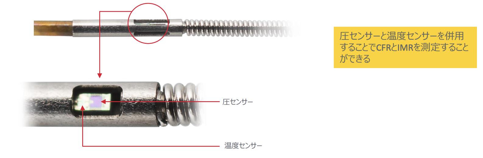 IMR/CFR測定手順を解説 | me